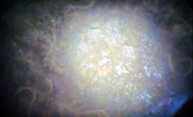 Microworms (Panagrellus redivivus) | Tropical Fish Keeping