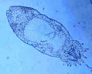 Flukes (Trematoda) | Tropical Fish Keeping